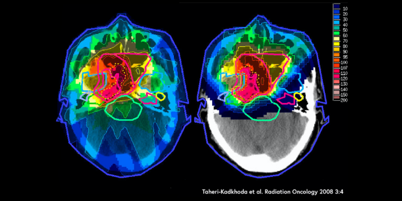 From the lab to patients: What today’s nuclear physics contributes to ...
