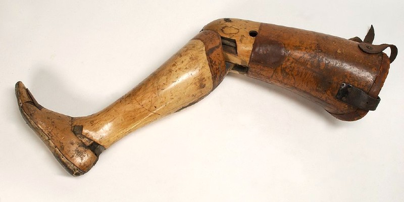 Prosthetics and Assistive Technology in Ancient Greece and Rome - News ...